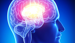 Webinar: Ischemic Strokes- User needs-driven development of ...