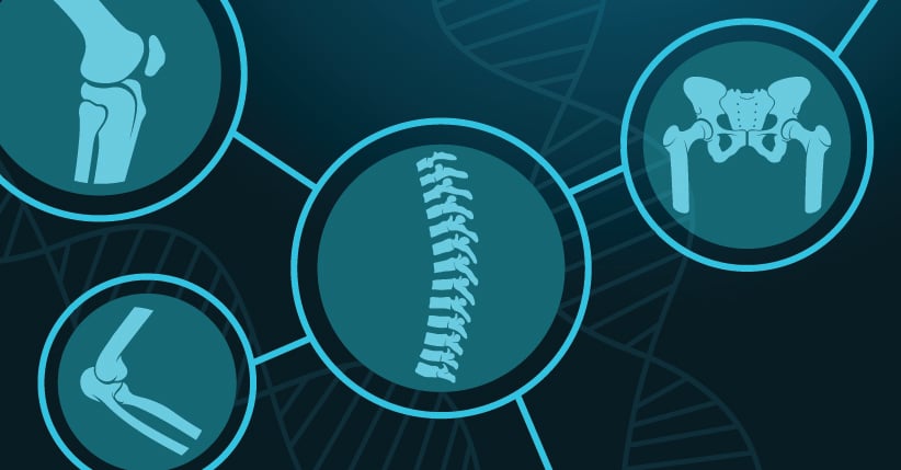 Webinar: Soft Suture Anchors & Metal Alternatives in Ortho Applications
